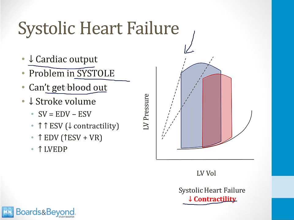 Cardiology - 6. Heart Failure - 2.Systolic and Diastolic Heart Failure