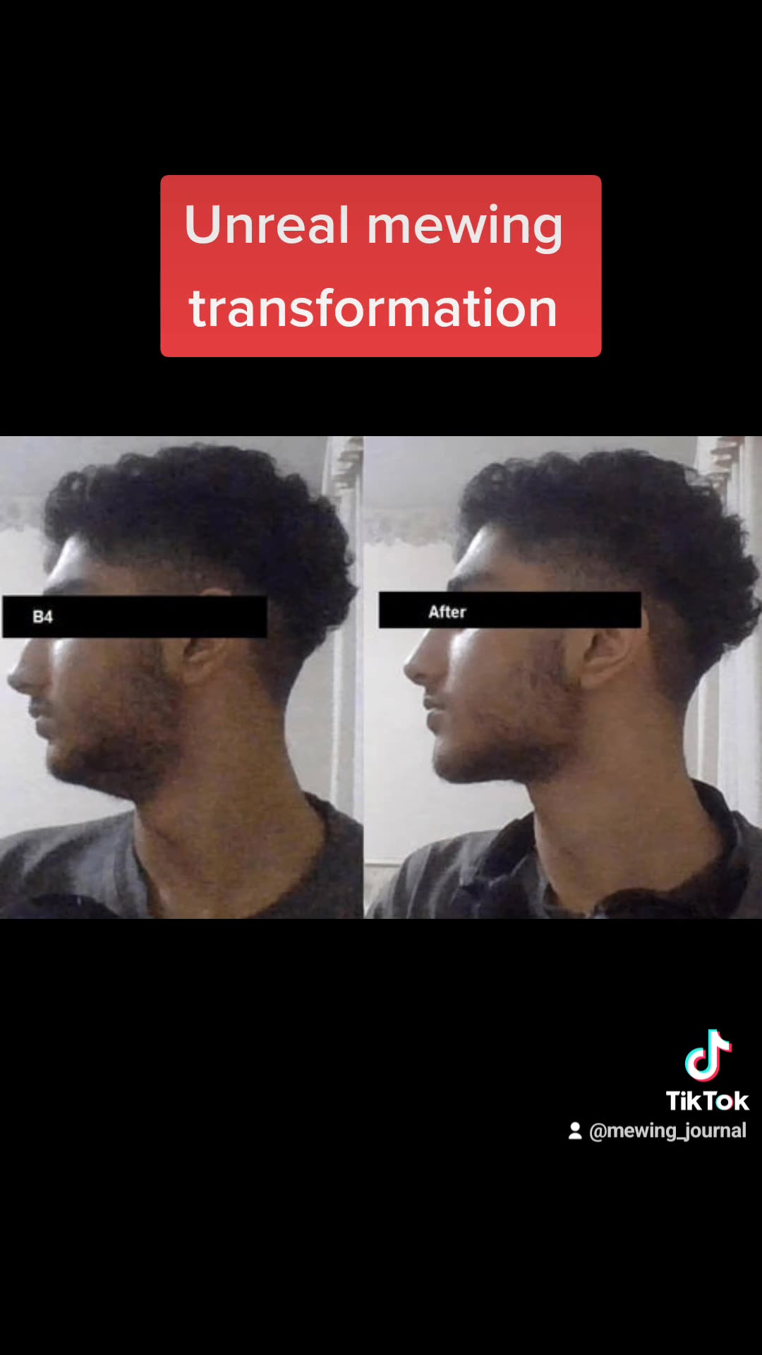 **unreal** mewing transformation!