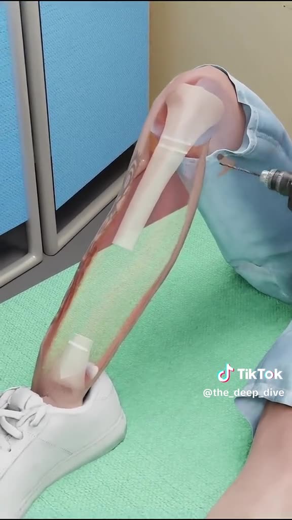 How does healing a broken bone work?