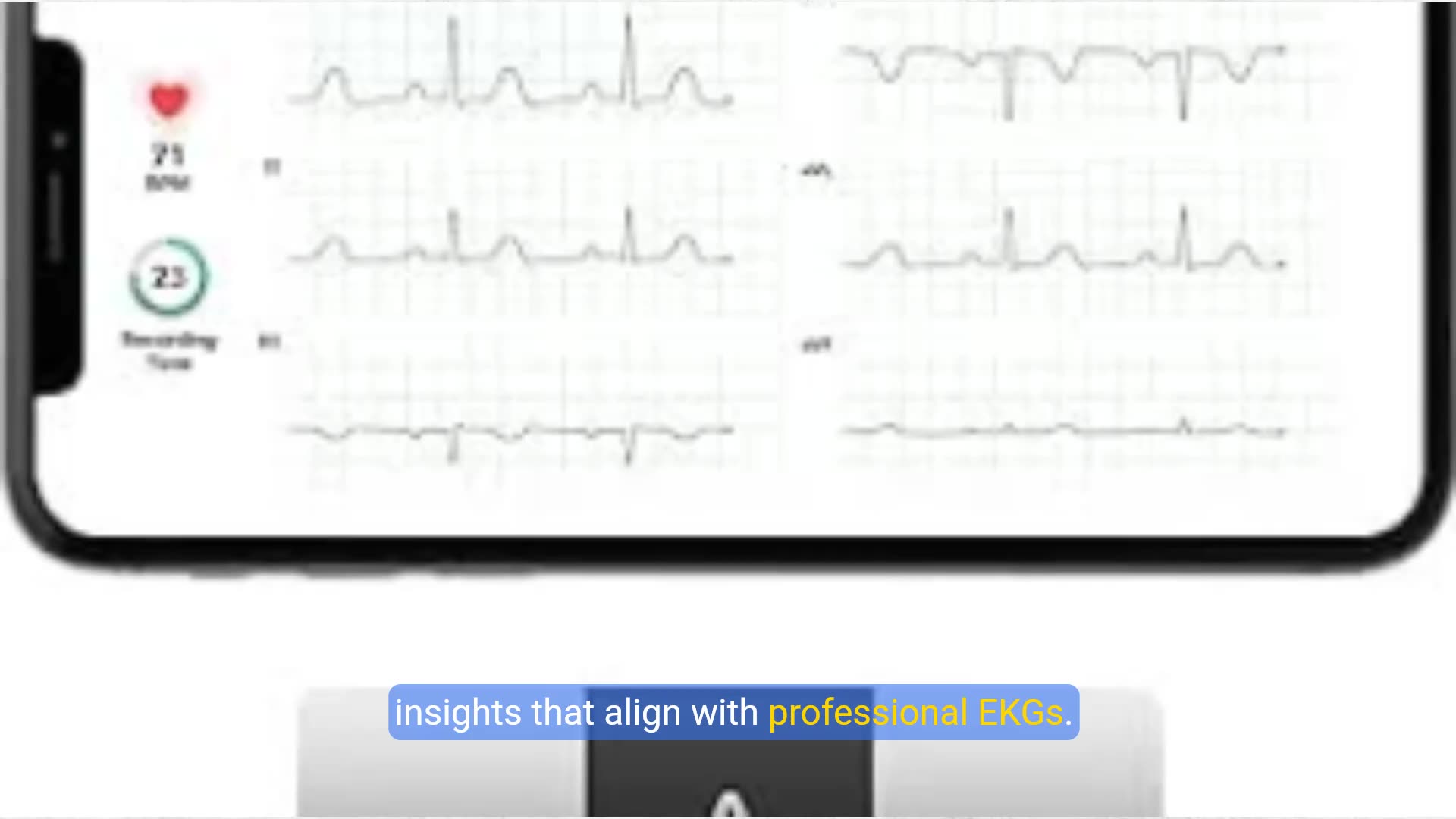 KardiaMobile 6L: Professional EKG Monitoring at Home | Medical Device ...