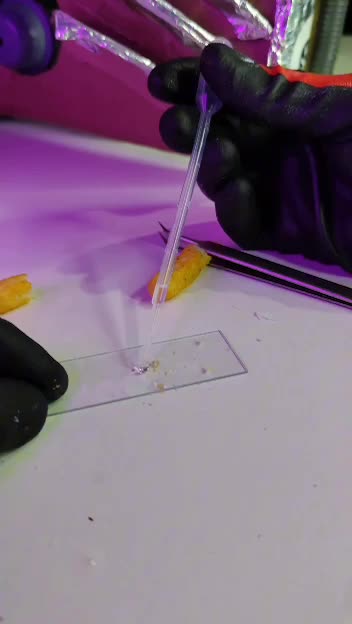 Parasites in Cheetos🕷️🪱; microscopic proof 🔥🔥🔥