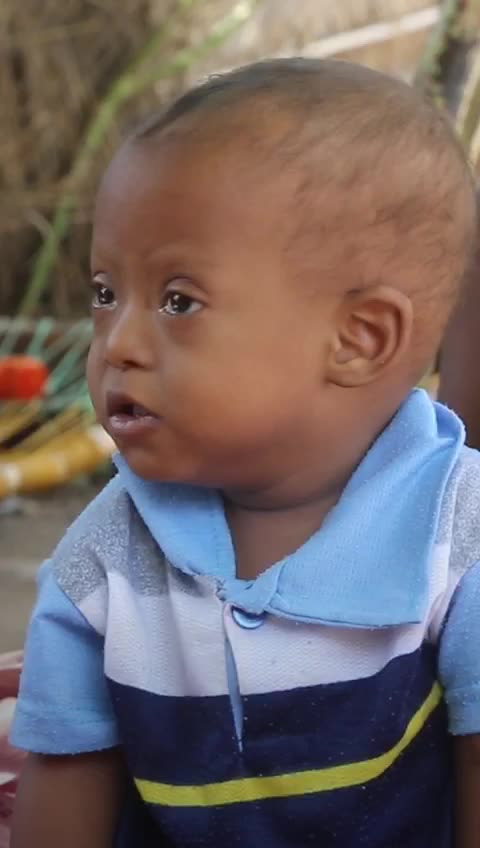 What is Mpox? Understanding Its Spread to Children and UNICEF's Actions