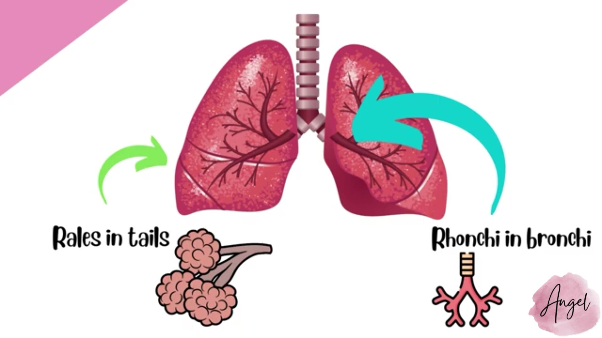 Rales vs Rhonchi and Mnemonics _ Explained _ Lecture _ Respiratory ...