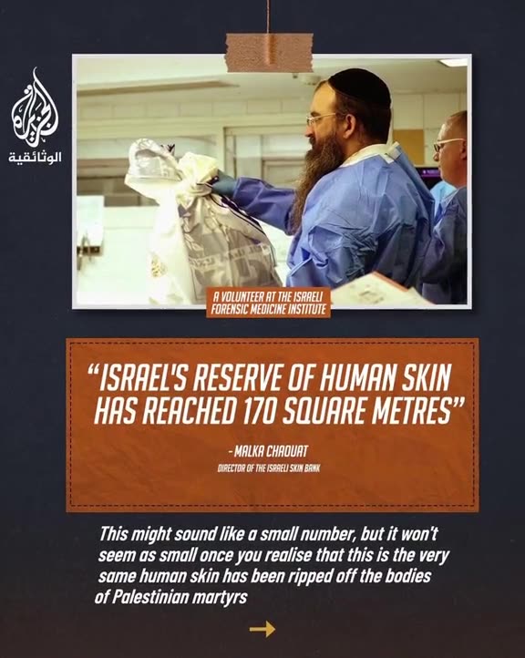 MUST WATCH IMPORTANT ISRAEL`S SKIN BANK - LARGEST IN THE WORLD