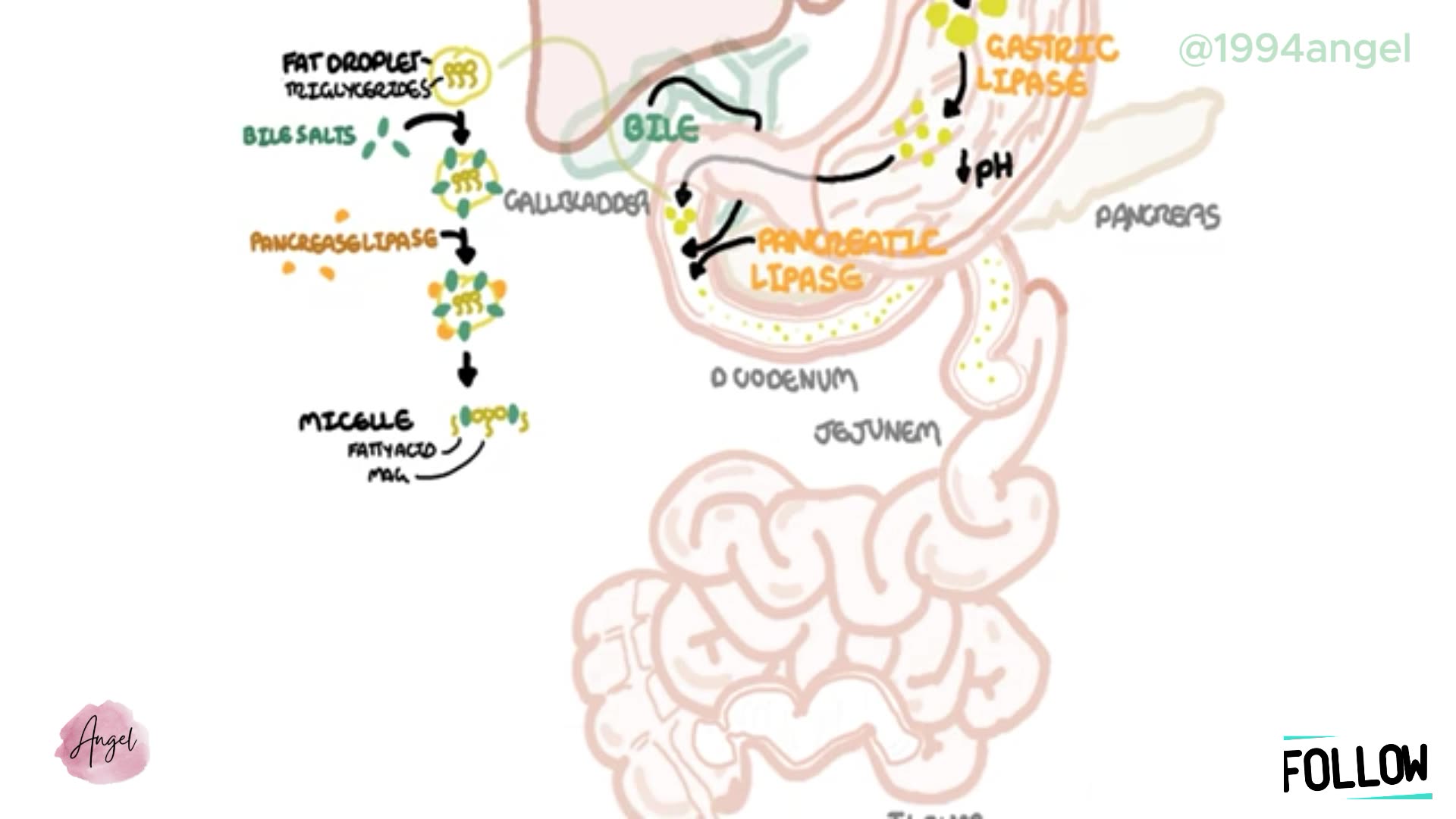 Approach to Fat malabsorption - signs and symptoms and causes