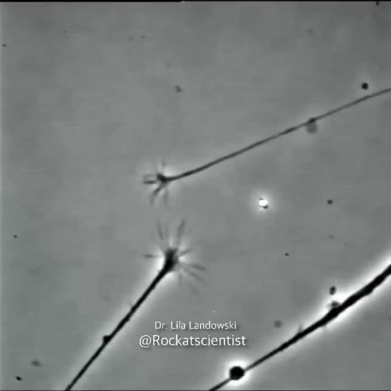 These are 2 neurons under the microscope watch them connect
